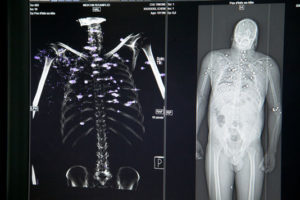 Virtopsie : L'autopsie virtuelle qui fait parler les morts - Police ...